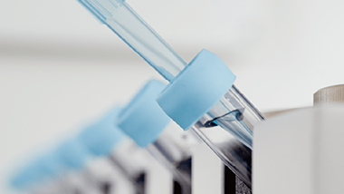 Transdermal Diffusion Testing Solutions for Pharmaceuticals